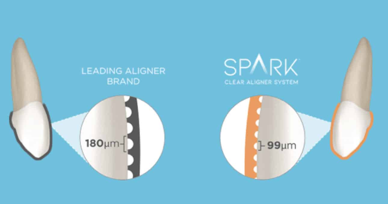 Spark vs Invisalign: What’s the difference? - Orthodontist Escondido CA ...