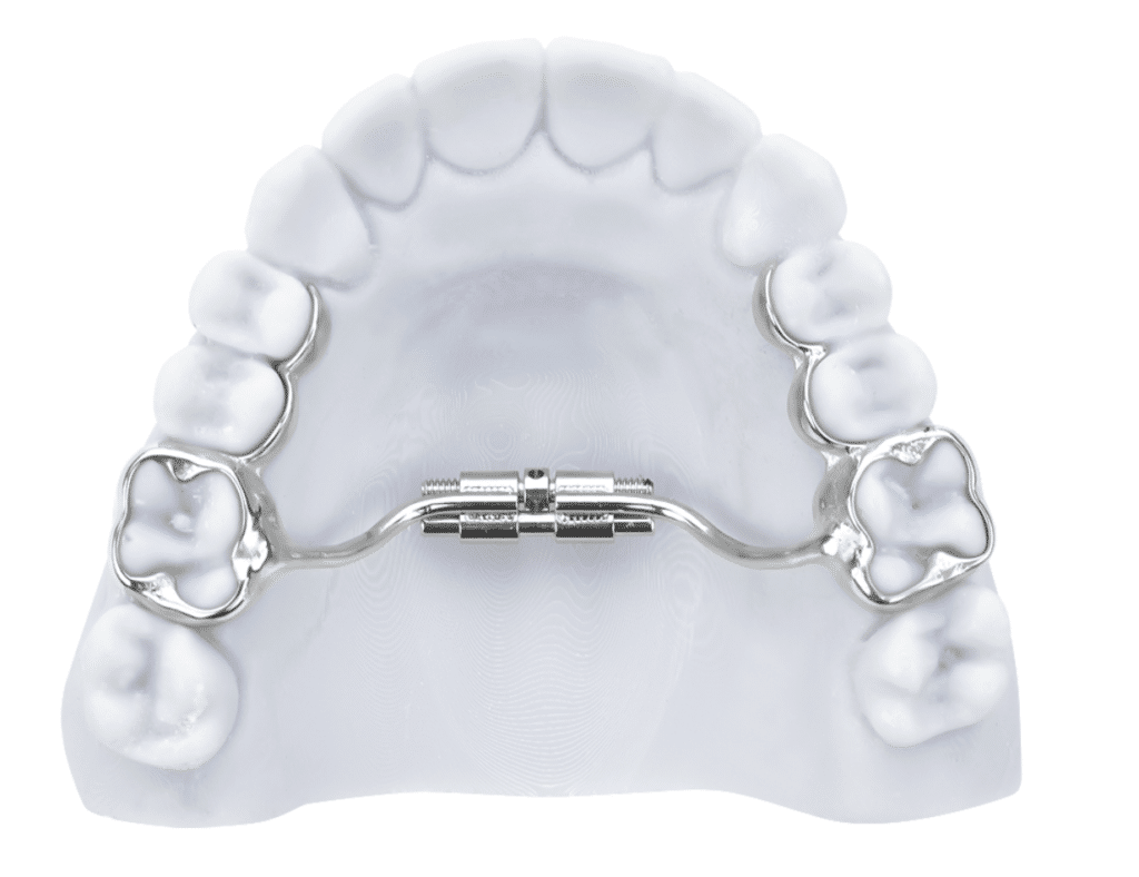 Orthodontic Expanders Escondido CA | Happier Smiles Orthodontics